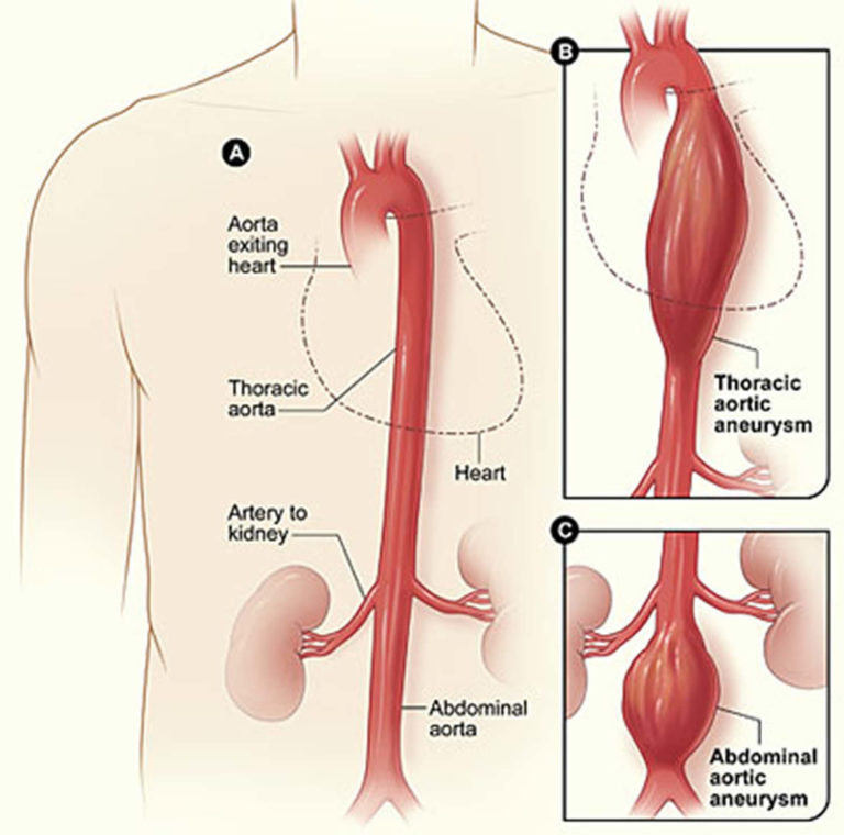 Aorta Anatomy Function Branches Location Aorta Problems