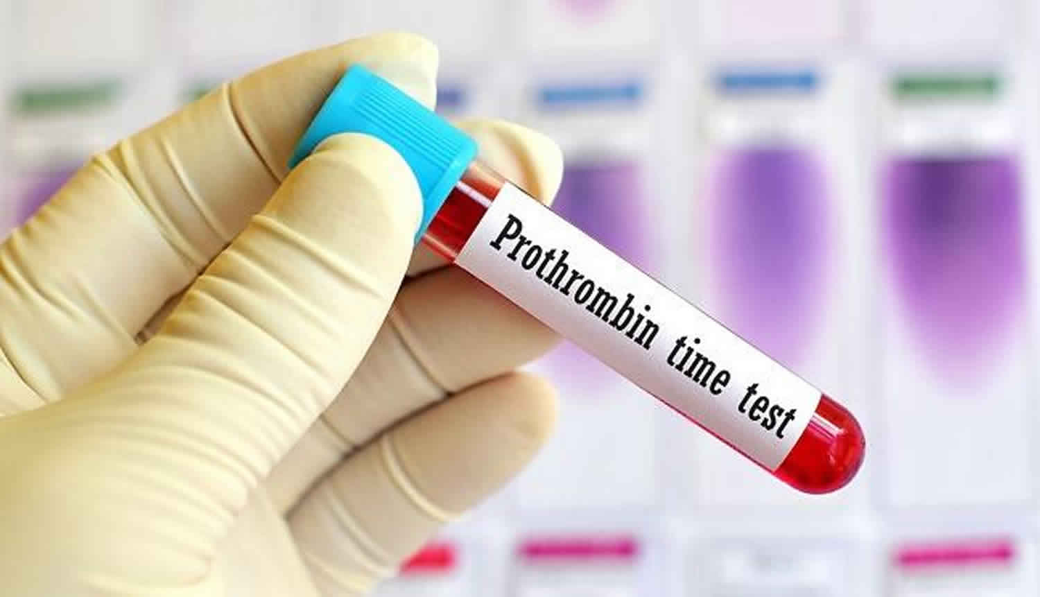Prothrombin Prothrombin Time Prothrombin Time Test Prothrombin Gene