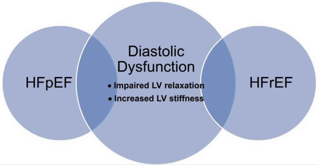 Diastolic dysfunction definition, causes, symptoms, diagnosis & treatment Diastolic dysfunction definition, causes, symptoms, diagnosis & treatment