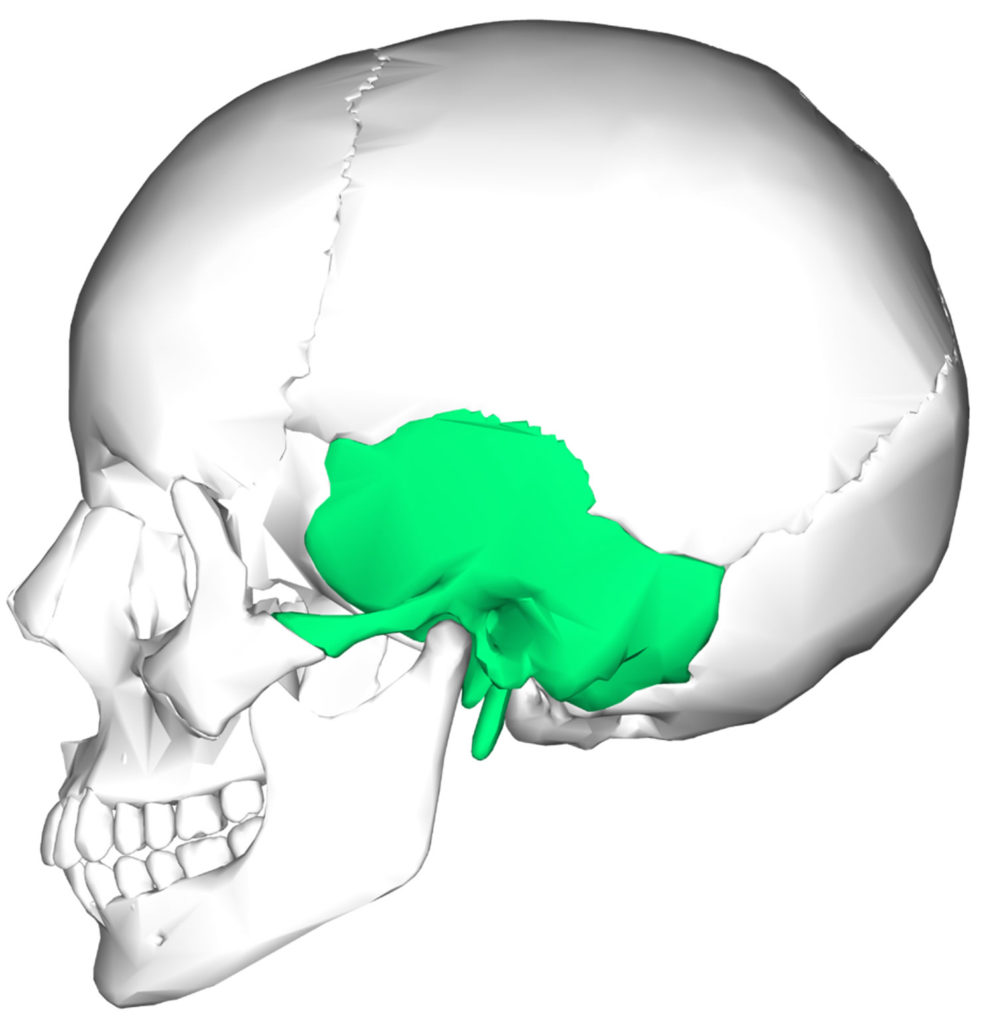 Temporal Bone Anatomy Parts Of Temporal Bone Temporal Bone Fracture