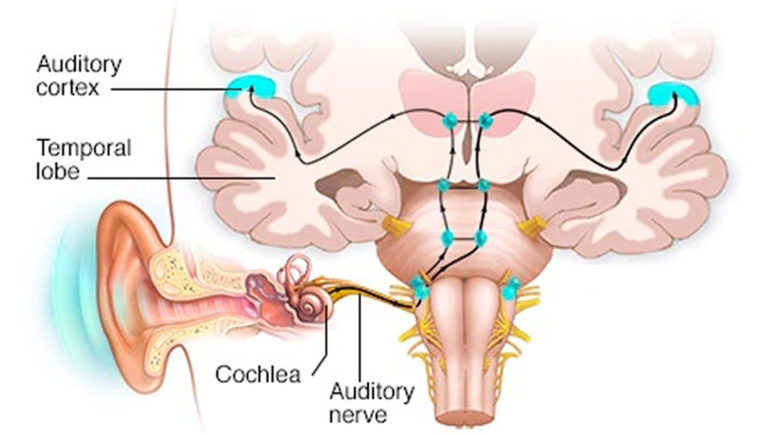 Auditory cortex, auditory area of brain location & function