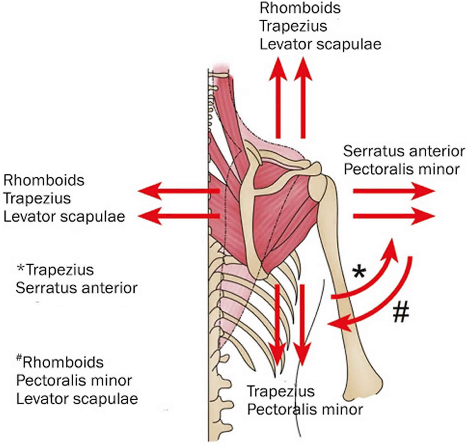 Snapping Scapula Syndrome Causes Symptoms Diagnosis Treatment